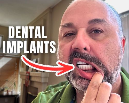 Are Dentures for Elderly People the Best Option? Pros and Cons