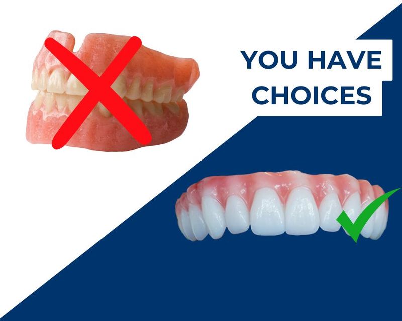 How You Could Save Money with This Alternative to Dentures