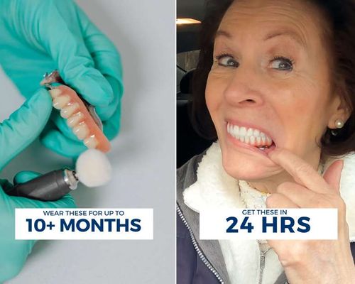 Permanent Teeth in 24Hrs vs Traditional Dental Implants