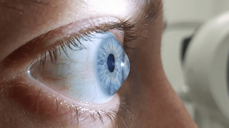 Netra Eye Institute | Holistic & Integrative Eye Care