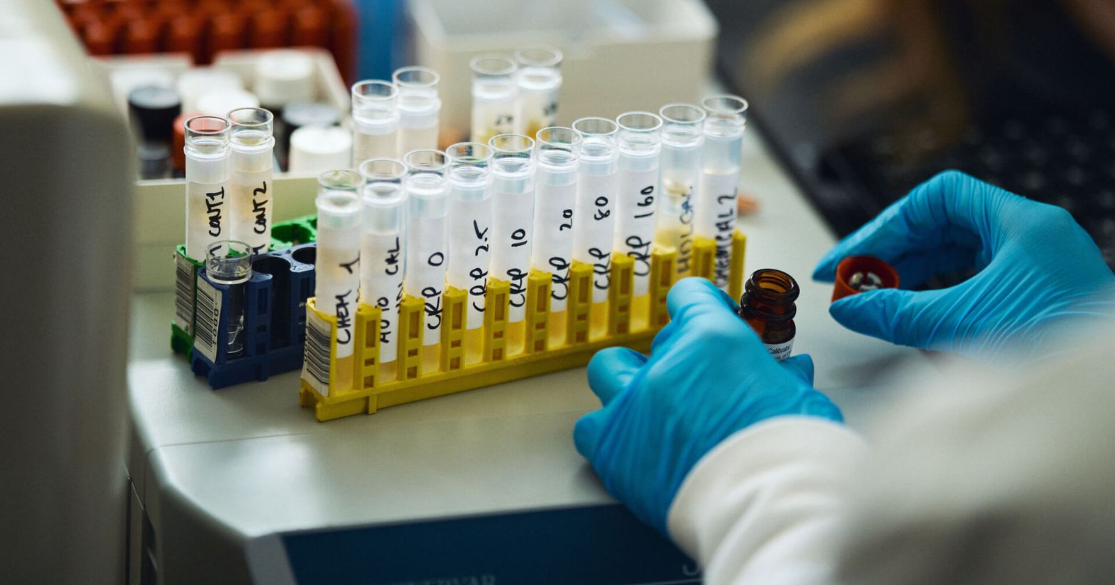 Hims & Hers acquires at-home lab testing facility, expanding ...