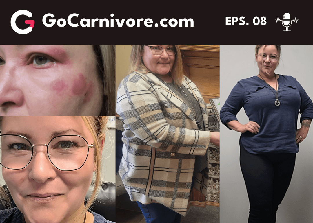 Carnivore Diet Before and After Photos: Carnivore Diet Results