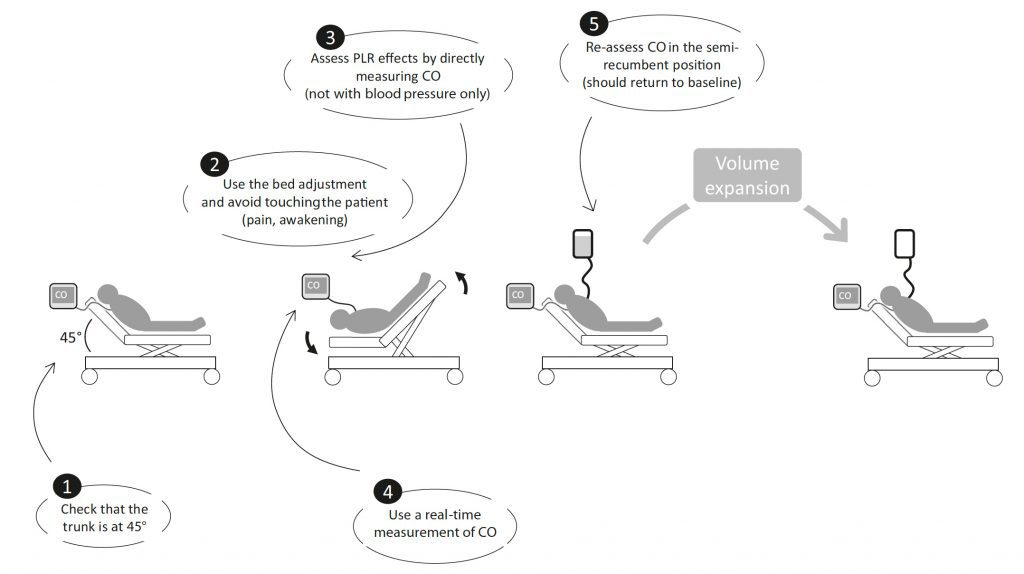 Afya Papers | Passive Leg Raising: o que todo médico precisa saber!