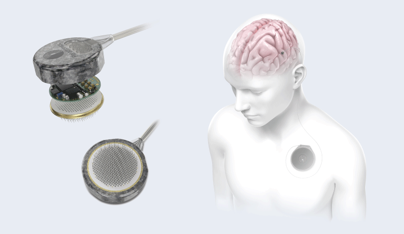 Preclinical research and neural signal stability | Proven longevity and ...