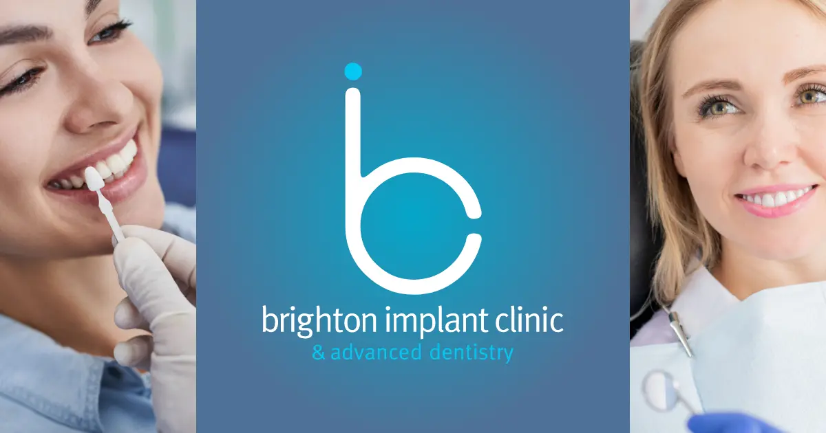 Dental Implants Prices