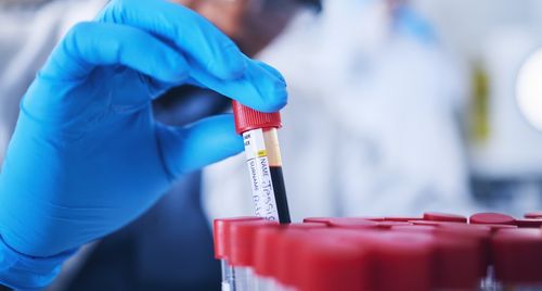 Research & clinical trials | QML Pathology