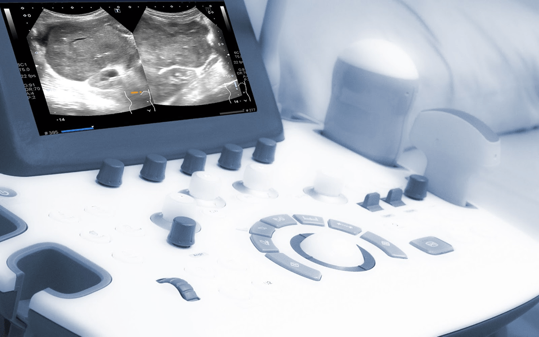 What Does a KUB Ultrasound Detect? Key Conditions