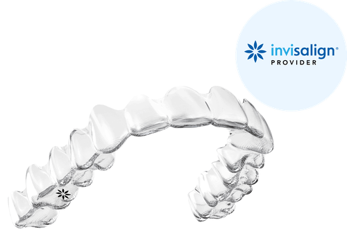 Invisalign: Todo Sobre Estos Alineadores Transparentes