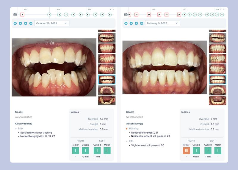 ProMonitoring - Powerful Remote Clear Aligner Monitoring
