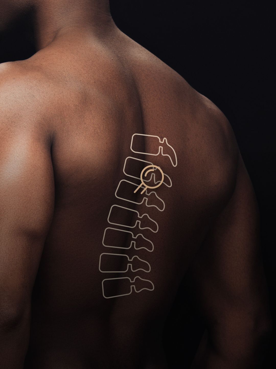Endoscopic Spine Surgery