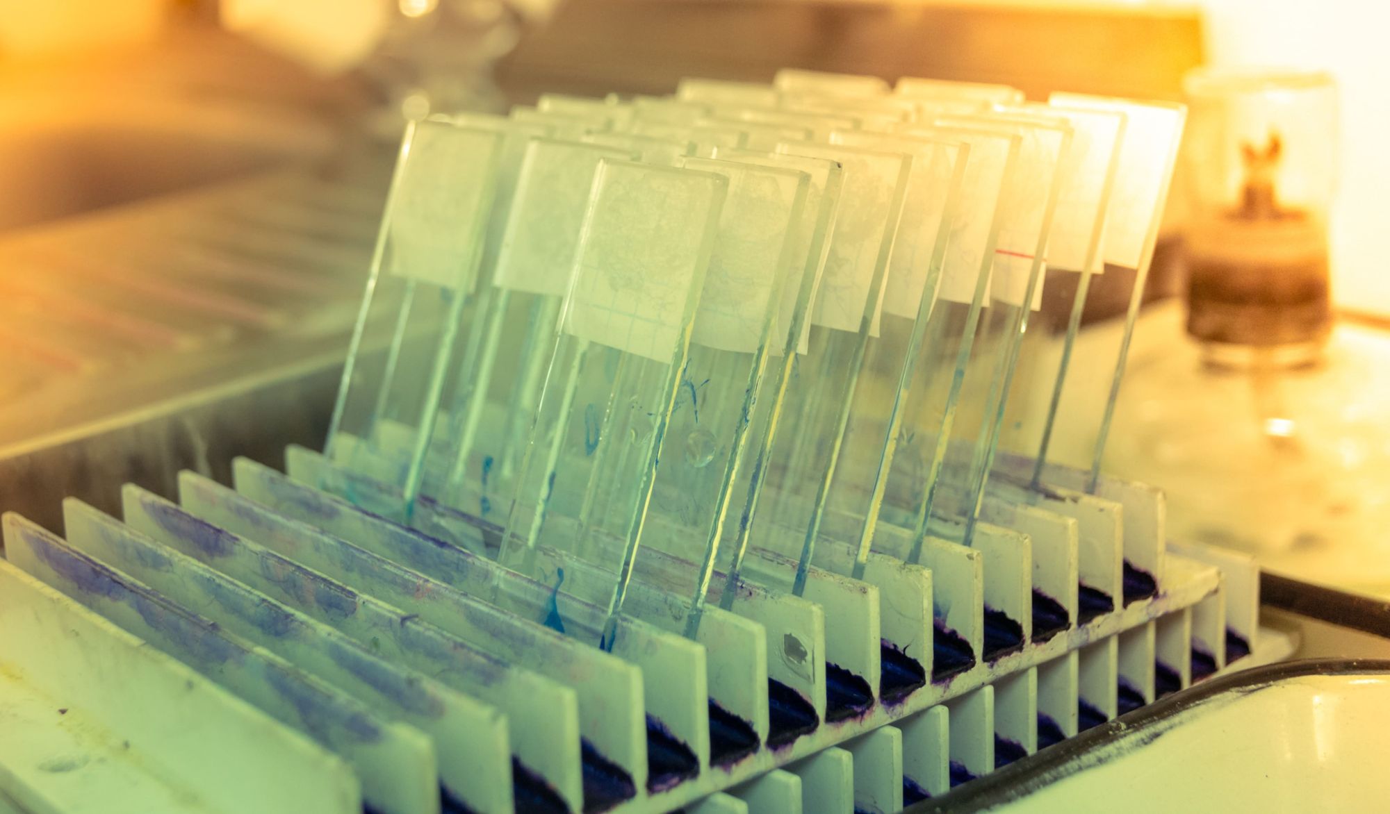 Parhelia Bio — Automating Spatial Biology with Pushbutton Precision.