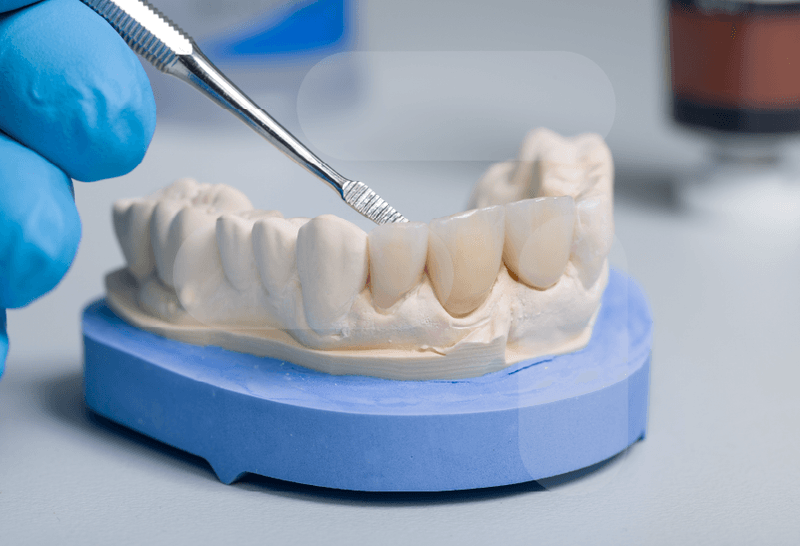 Imprimante 3D dentaire Sentry 220 | Fabriquée en France | 3DTOTEM