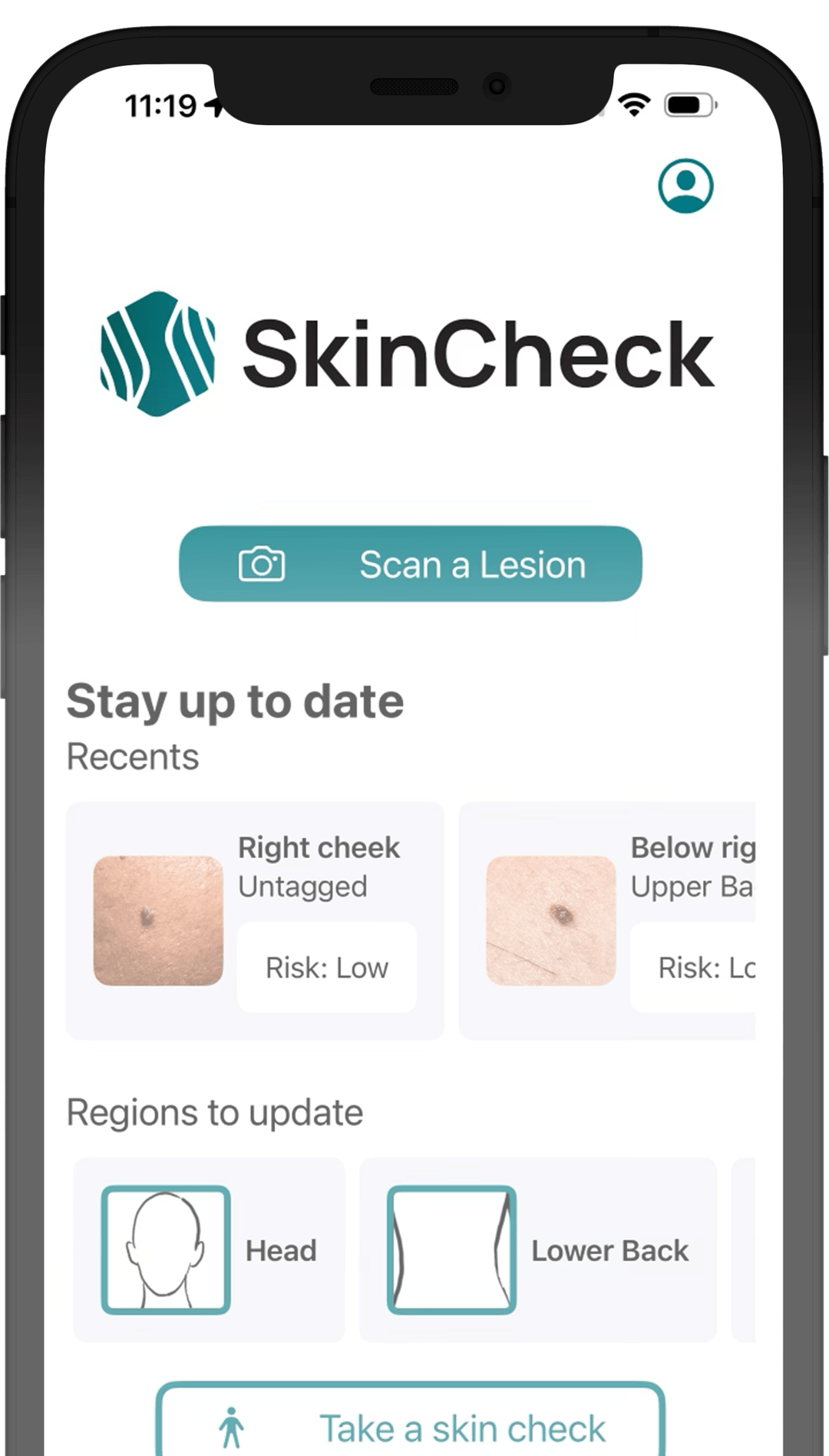 SkinCheck