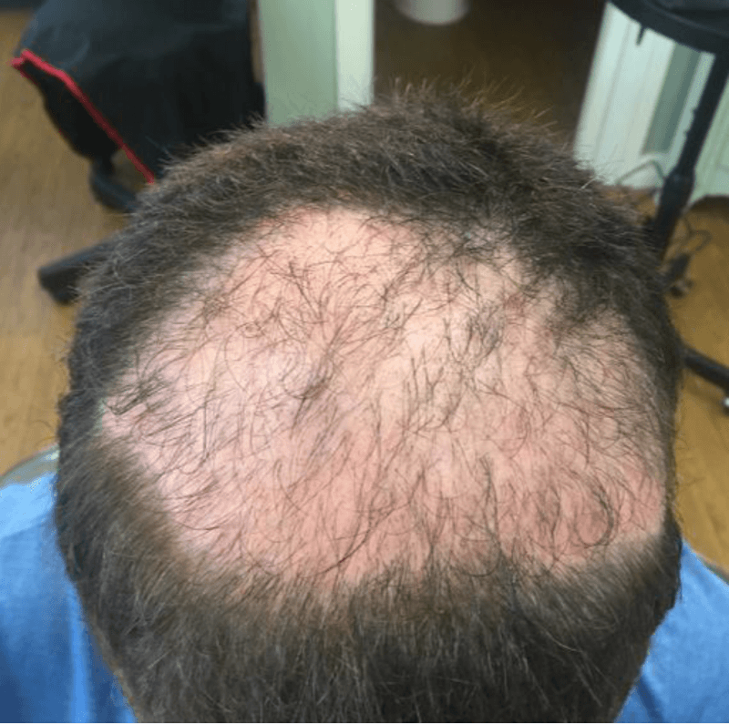 United States Trichology Institute | Expert Hair Loss & Scalp Health ...