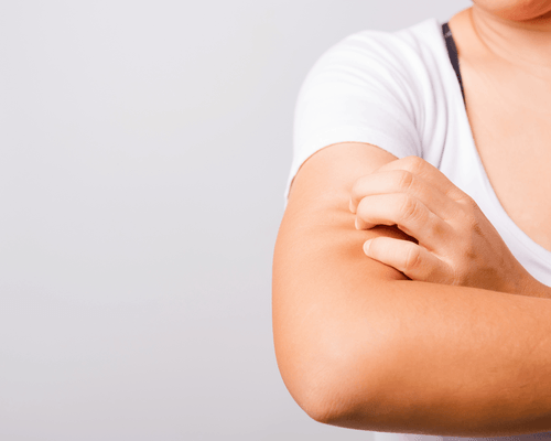 Mounjaro® Skin Sensitivity: Skin Side Effects & How To Manage Them