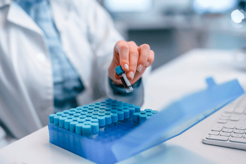 Guide to Lab Sample Management: How Labs Can Take Full Control of Their ...