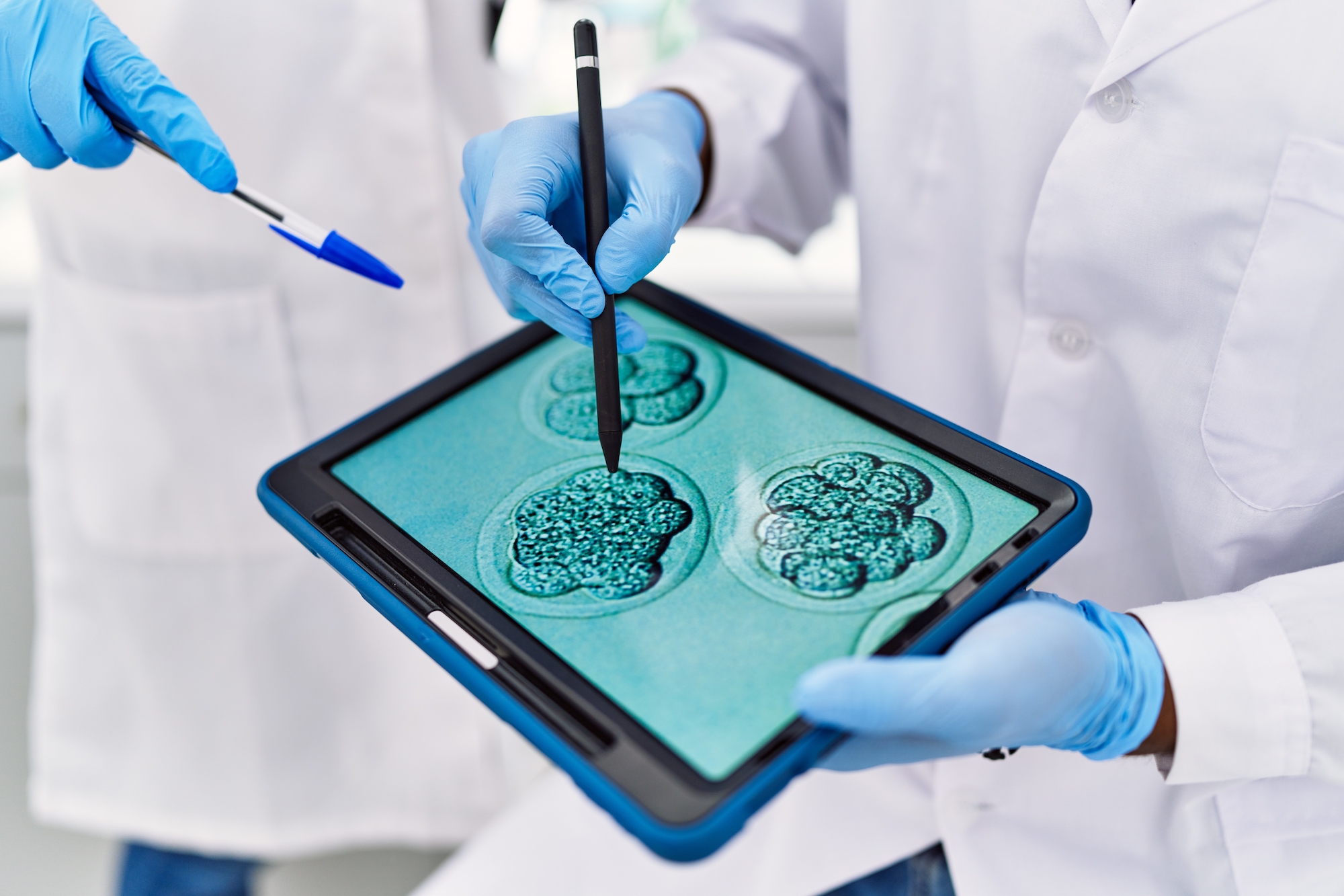 Fresh vs. Frozen Embryo Transfer | Fertilitywise