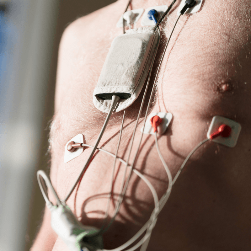 24-72 Hour or 7-Day ECG Monitoring – Treatment | The LivingCare Group