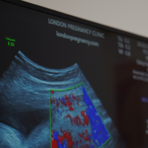 DVT Ultrasound Scan | Spital Clinic London