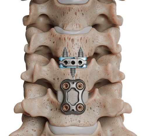 Elevation Spine
