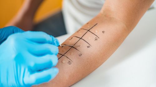 Are Allergy Tests Always Accurate? Understanding Limitations and ...