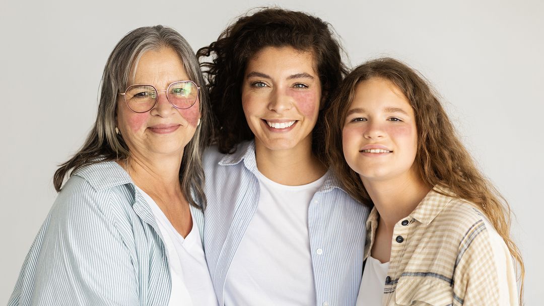 Is Lupus Hereditary? Understanding Genetic Risk Factors