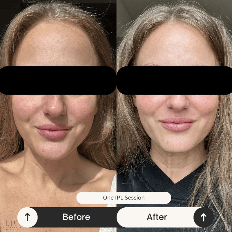 Sangini Patel, M.S., PA-C | Liv Aesthetics Chicago | Aesthetic Medicine ...