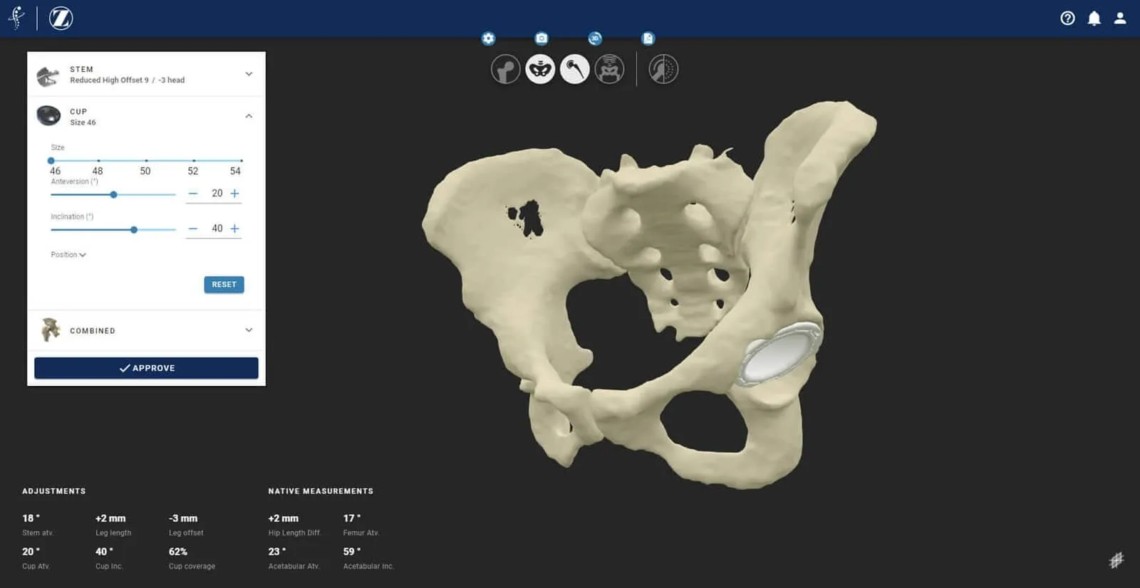 Formus Labs | The Future of Orthopaedic Planning