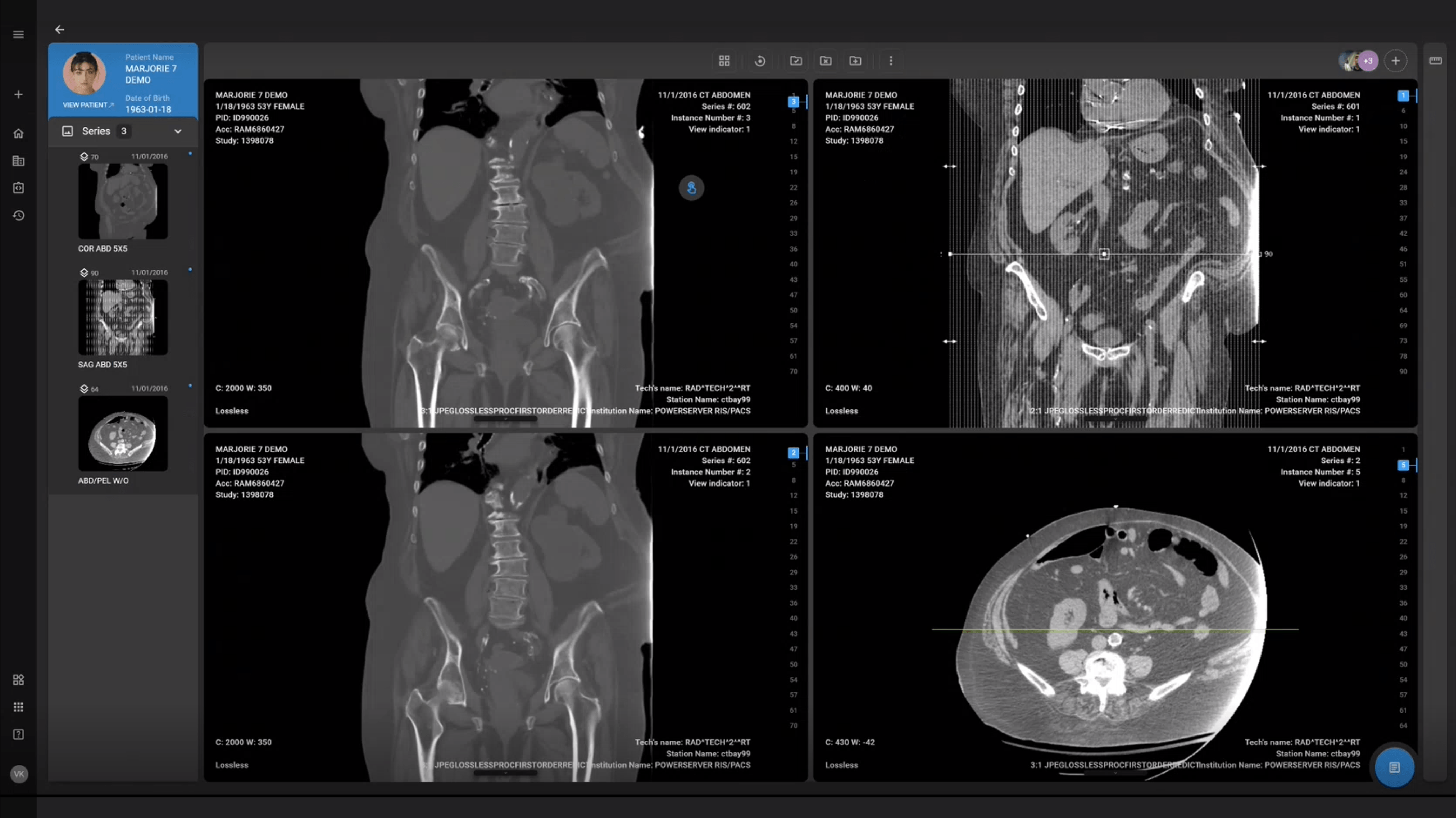 Advancements in PACS Radiology Software
