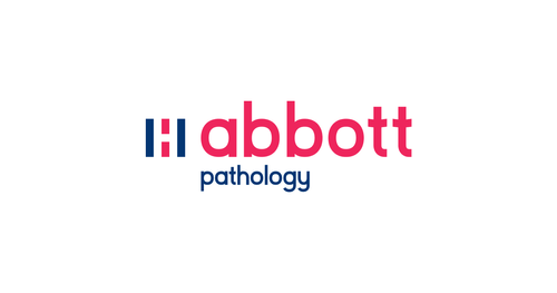 Faeces Collection (not for 3 Day Faecal Fat) | Abbott Pathology