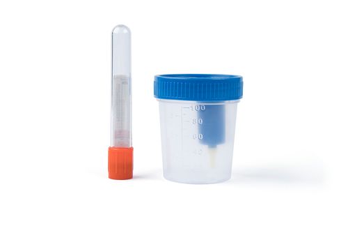 Abbott Pathology - Pathology diagnostics & testing services in South ...