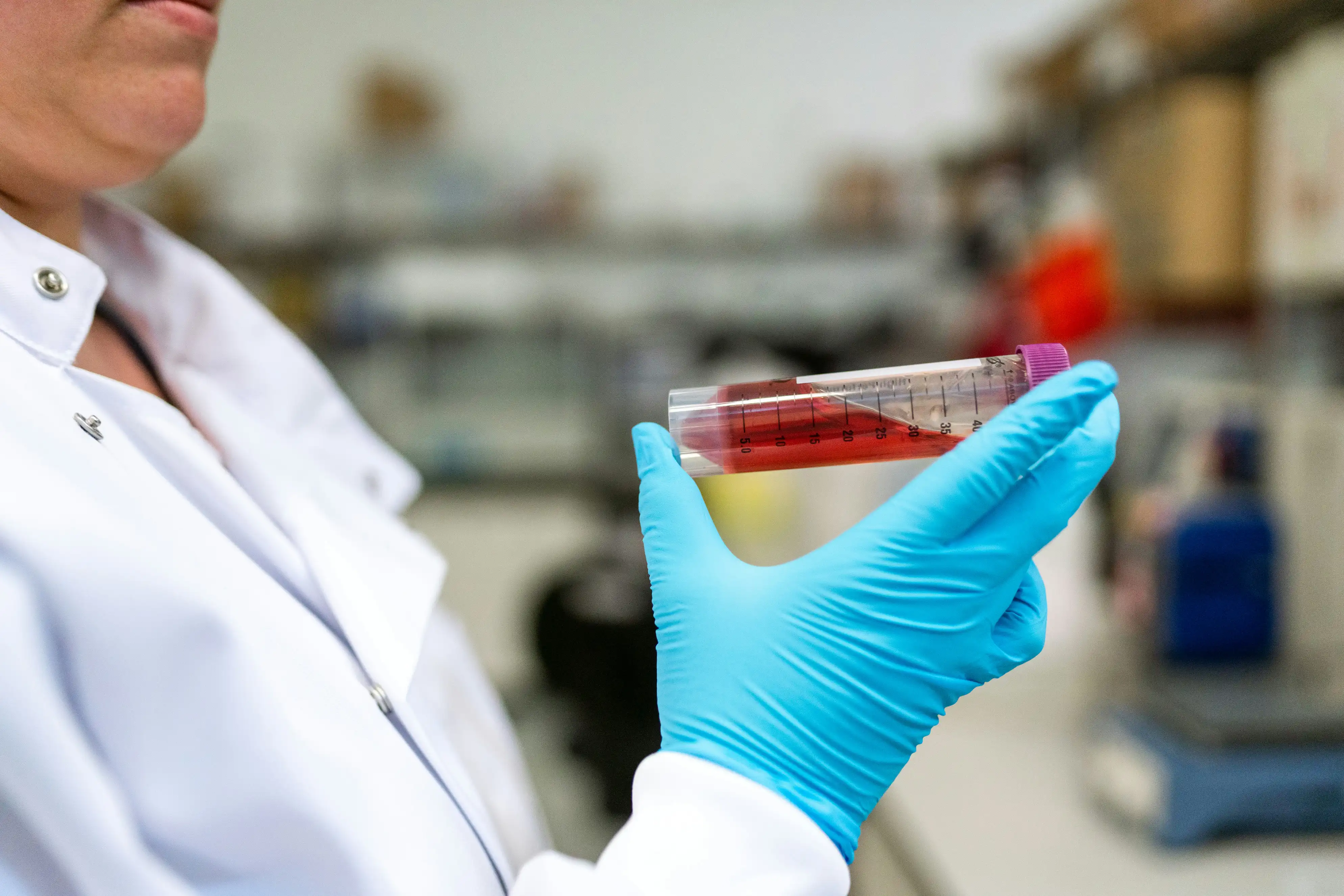 Longevity Blood Test: What to Ask Your Doctor