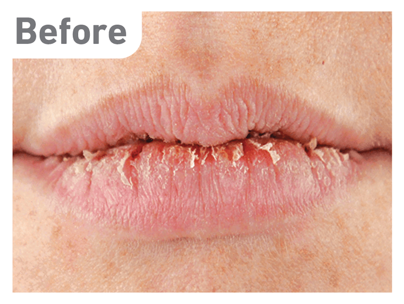 O'Keeffe's Lip Repair Unscented: Guaranteed Relief for Extremely Dry ...