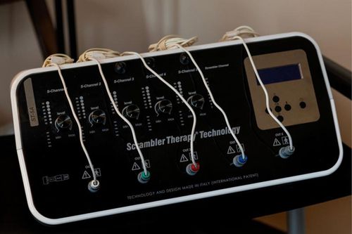 ‍How Scrambler Therapy Was Developed: A Historical Overview