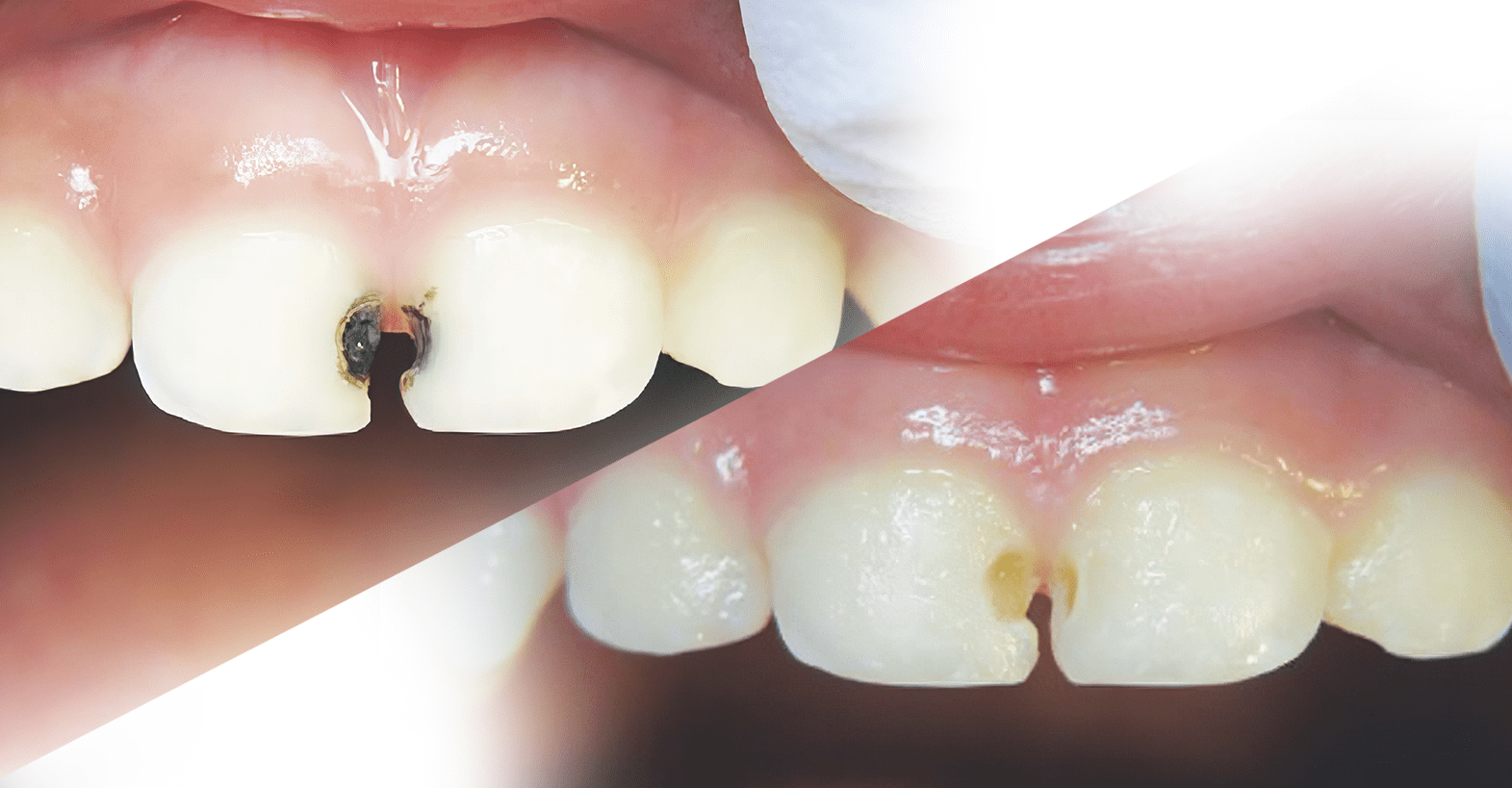 Art Of Pediatric Dentistry Kids Dentist In Bellevue WA Art Of Pediatric Dentistry Kids Dentist In Bellevue WA