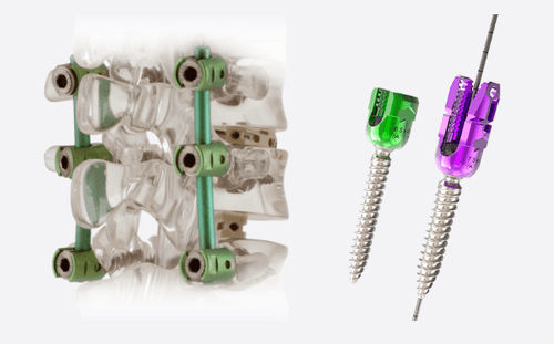 Spinal Fixation | Spartan Medical