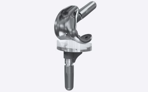 Total Knee Arthroplasty (TKA) | Spartan Medical