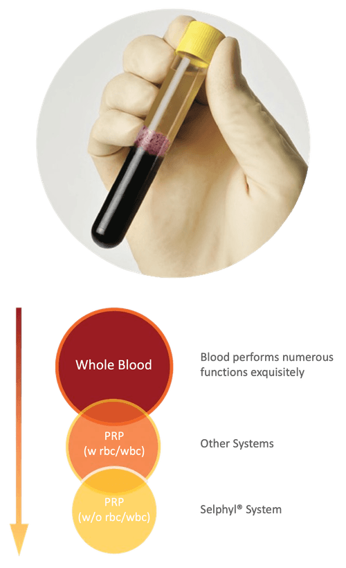 Selphyl Platelet Rich Plasma (PRP) System | Spartan Medical