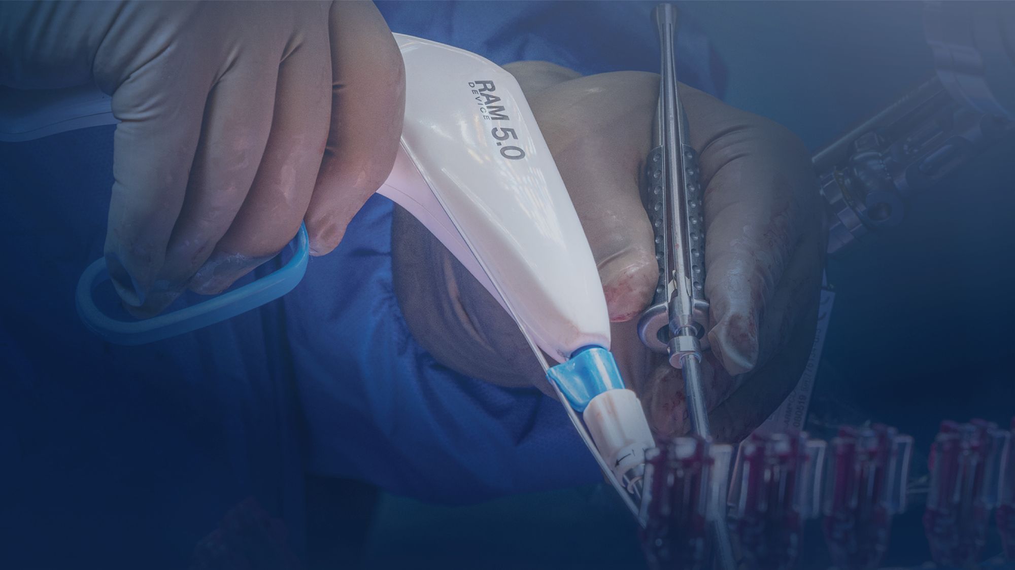 LSI SOLUTIONS® - Leading Surgical Innovation
