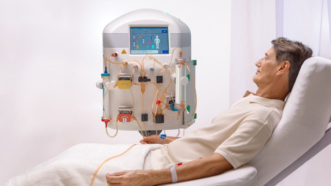 Blood Plasma Purification Treatment | Inuspheresis®
