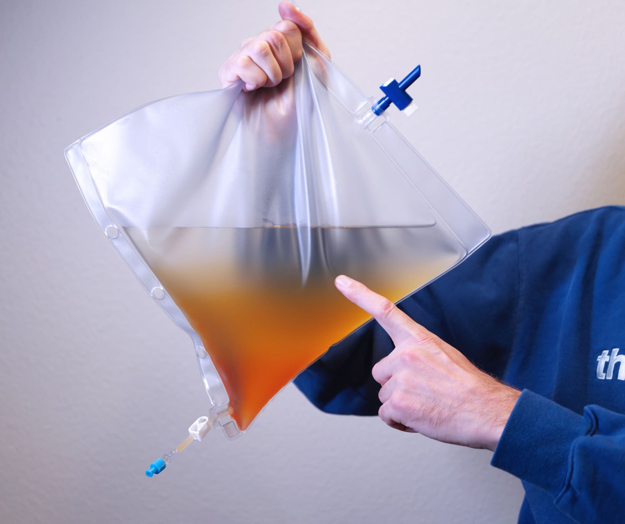 Blood Plasma Purification Treatment | Inuspheresis®
