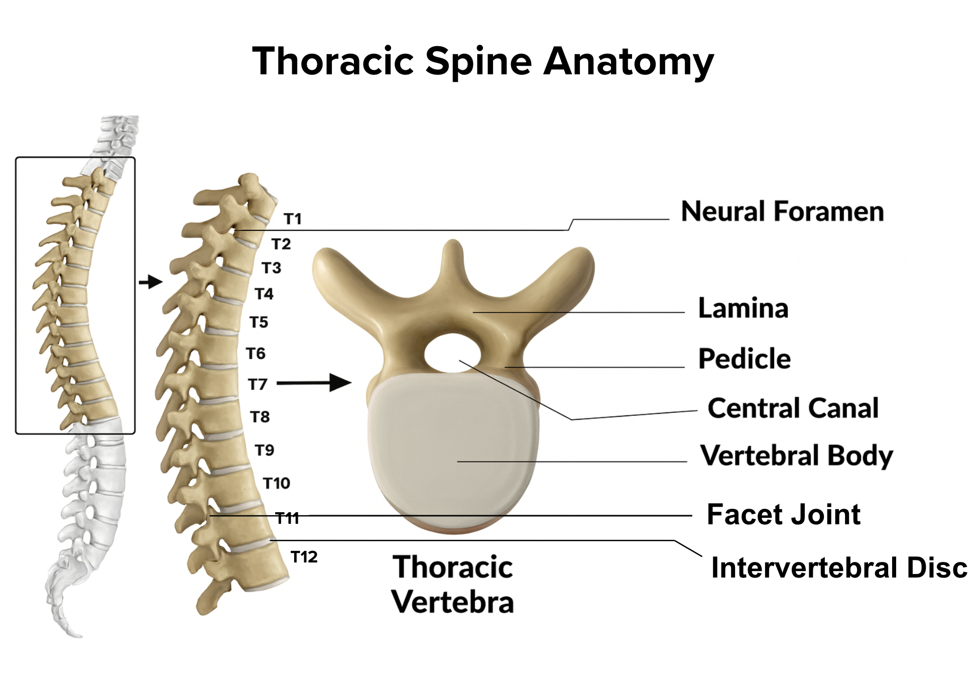 How to Plan a Thoracic Spine MRI Protocol – EASY Video Guide