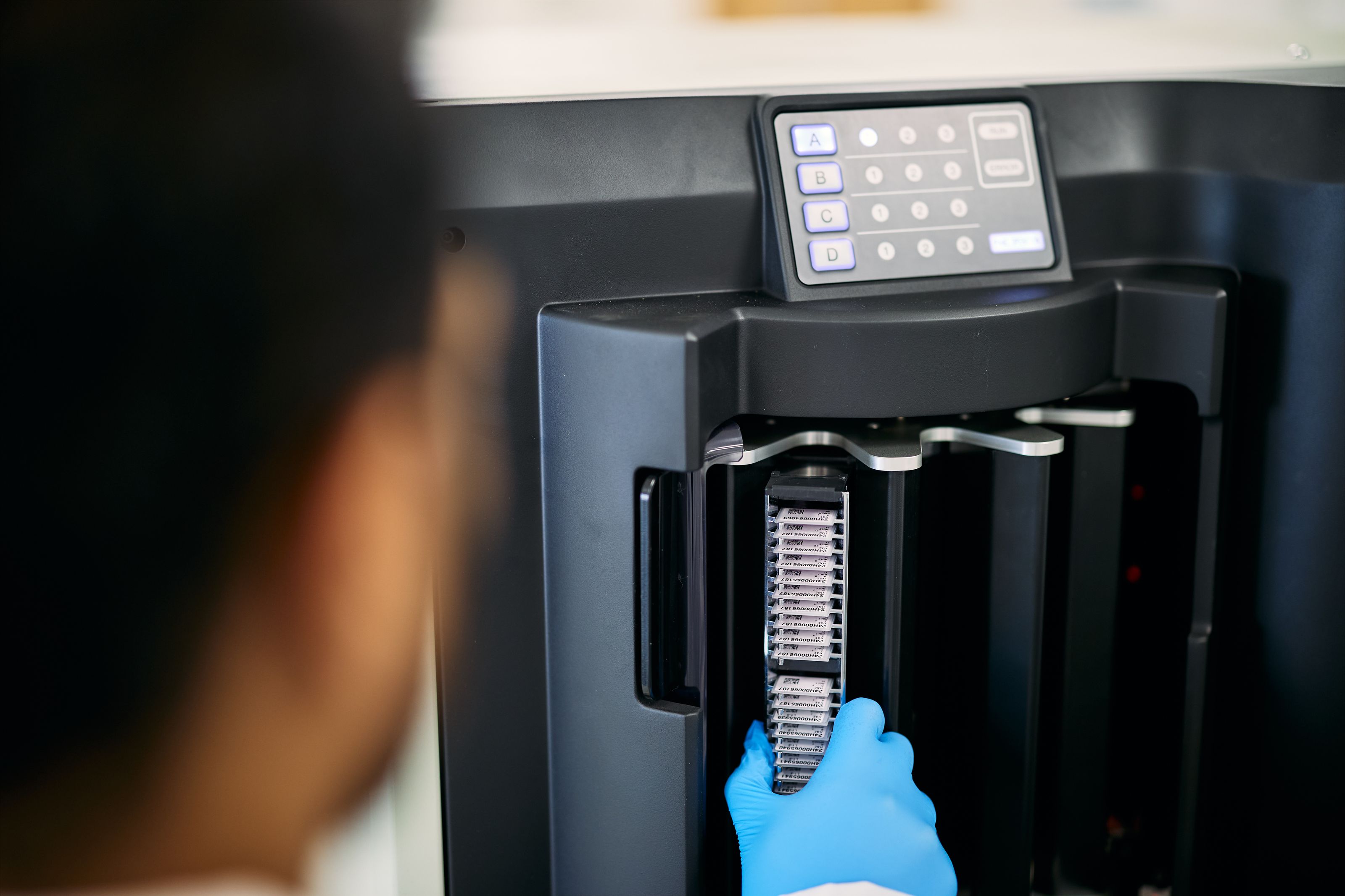 Reducing NHS wait times from 2 months to 2 days