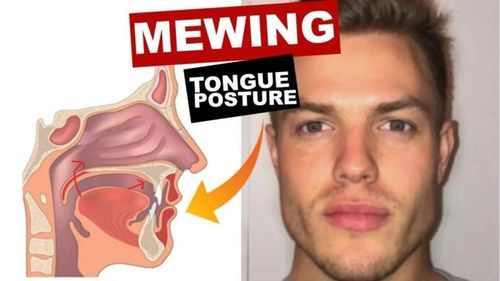The Truth About Mewing: Can You Really Reshape Your Jawline?
