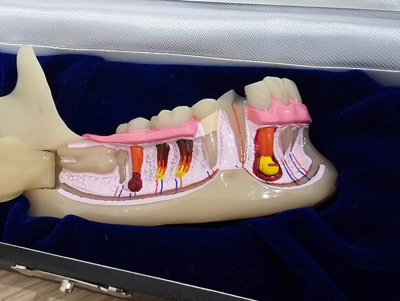 Dento-alveolar Surgery in Perth, Albany & Geraldton | Oral Surgery Experts