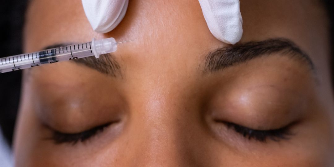 Facial Balancing: What to Expect | SkinSpirit