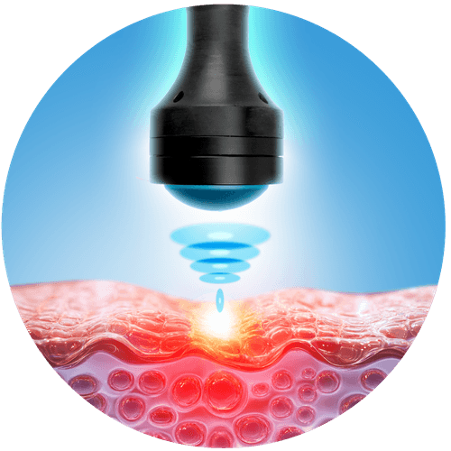 CellSonic Regeneration | Non-Invasive Healing Technology