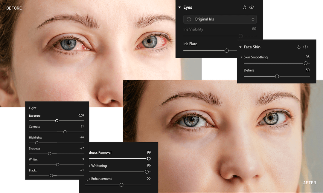 Aperty Eye Editor: The Key to Simple Eye Perfection