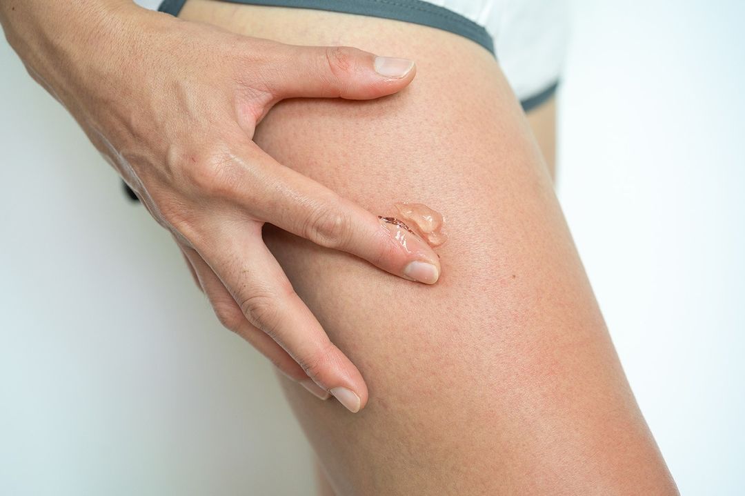 Testosterone gel and cream: what you need to know