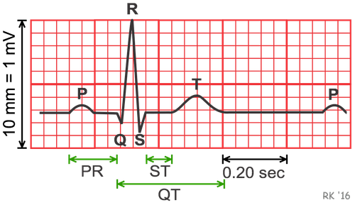 Cardio Calipers, On-Screen Electrocardiogram (EKG, ECG) Measurement